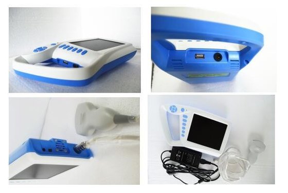 2017 High End Wireless Smartphone Ultrasound Scanner for Anesthesiology Puncture