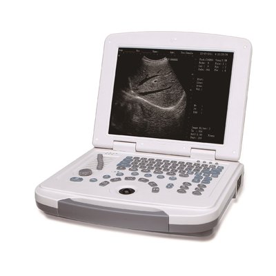 Mini Portable Laptop Ultrasound Equipment Doppler