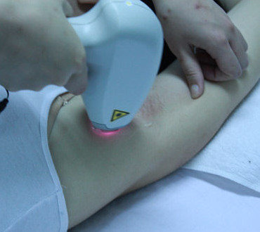 1 - 9hz Frequency 808 Laser Hair Removal Device 600w No Pigment Accumulation